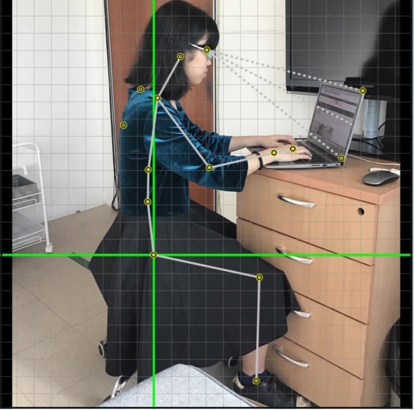 Professional Sitting Posture Analysis - Singapore Chiropractor